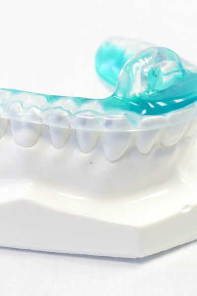 functional orthoticdesign | Just another WordPress site