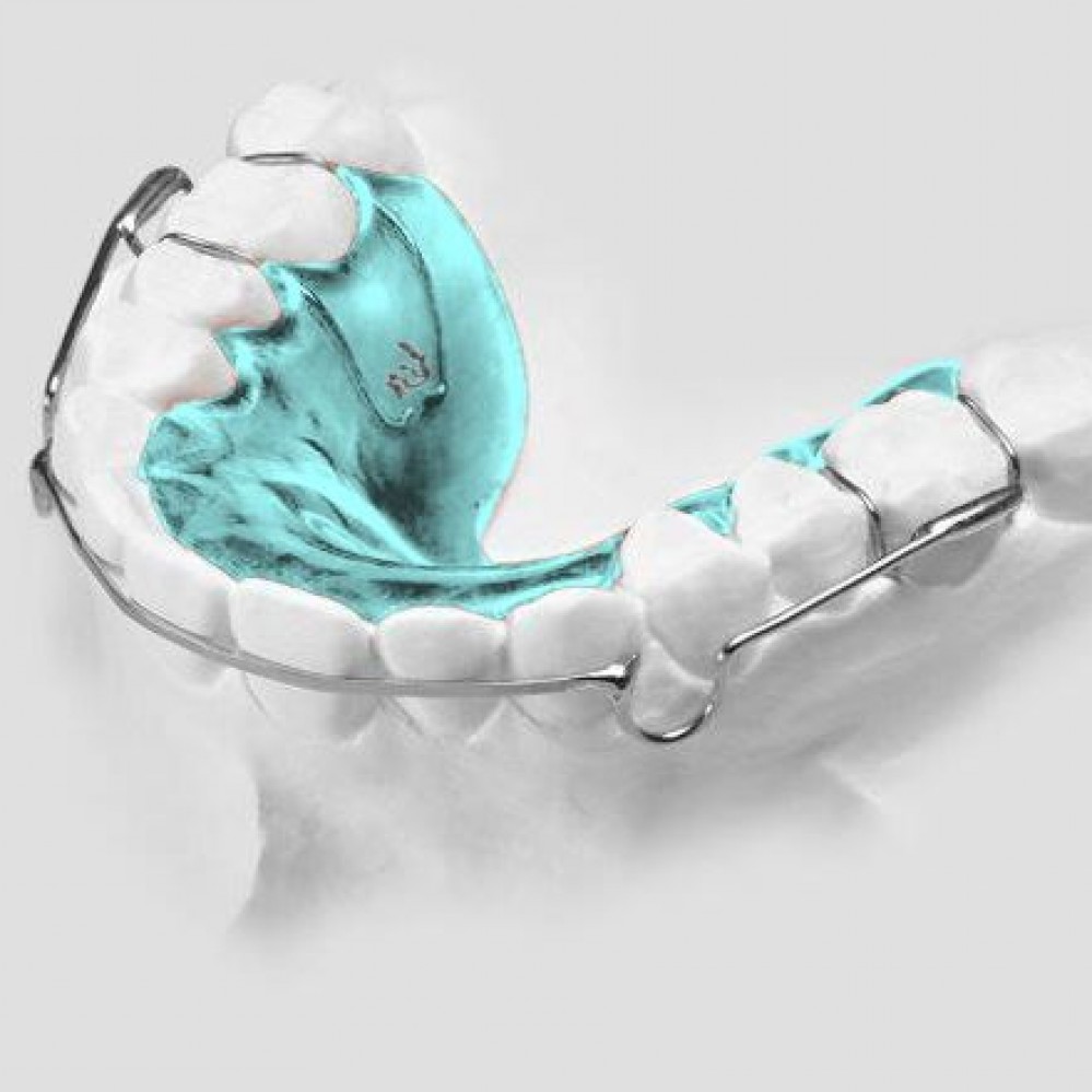 Aligners & Retainers | functional orthoticdesign