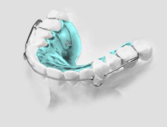 Aligners & Retainers | functional orthoticdesign