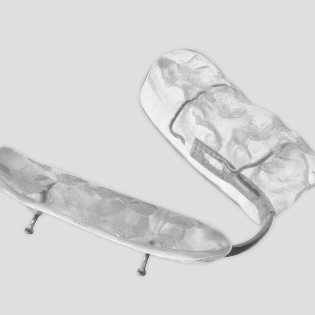 Gelb Splint (Gelb-MORA) | functional orthoticdesign