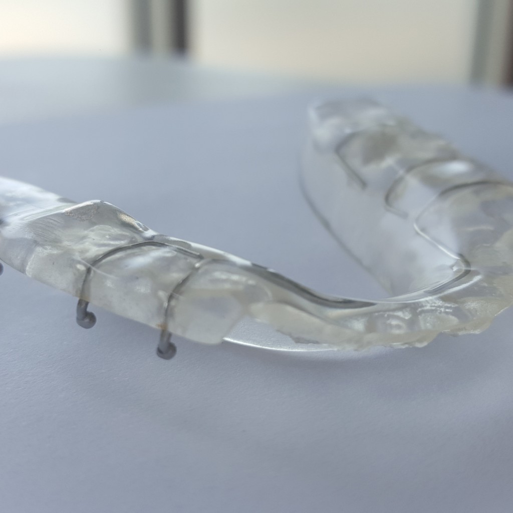 Pivot Splint | functional orthoticdesign